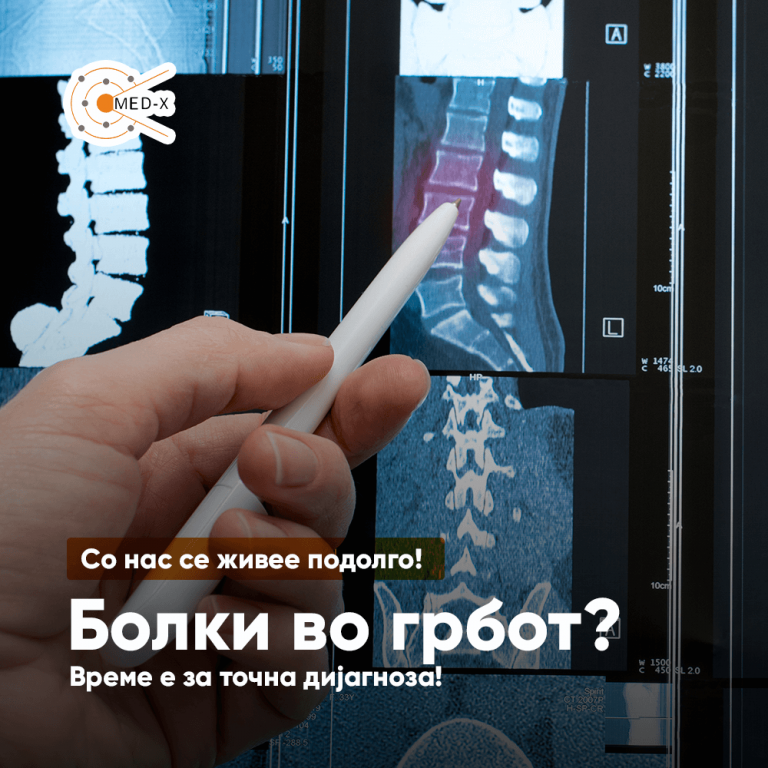 Болки во грбот: Симптоми, Причини и Дијагностика - Med-X